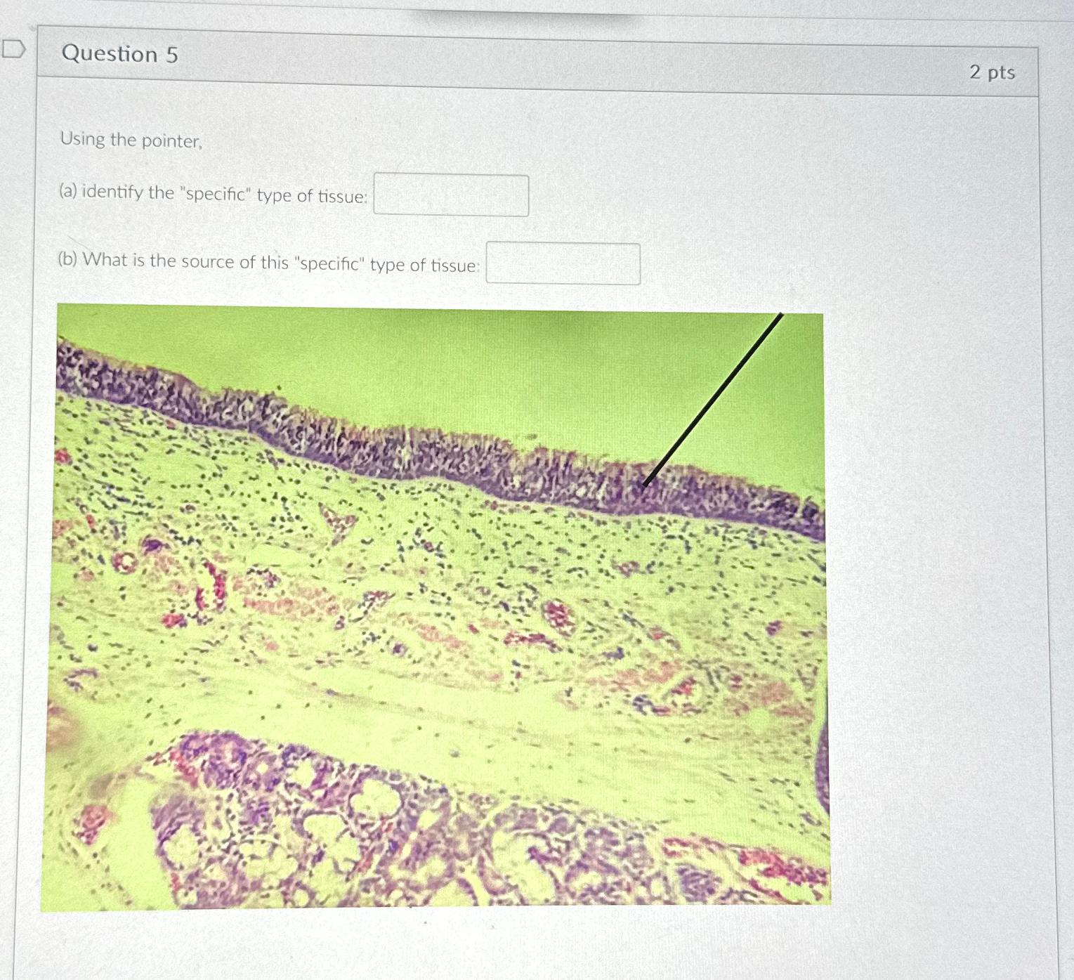 Solved Question 52 ﻿ptsUsing the pointer,(a) ﻿identify the | Chegg.com