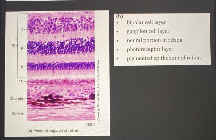 Solved (b) bipolar cell layer ganglion cell layer neural | Chegg.com