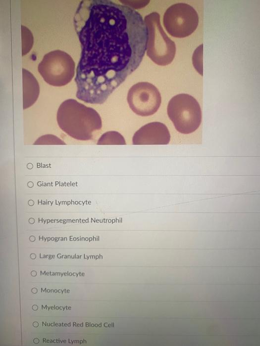 Solved Blast Giant Platelet O Hairy Lymphocyte | Chegg.com