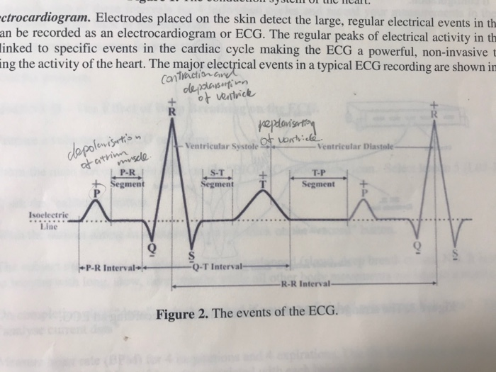 Solved After exercise, how does the PR interval, RT interval | Chegg.com