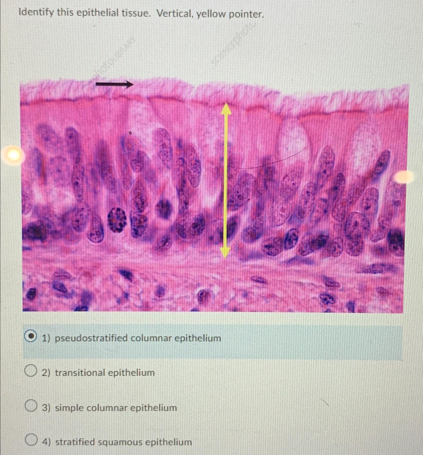 Solved Identify this epithelial tissue. Vertical, yellow | Chegg.com