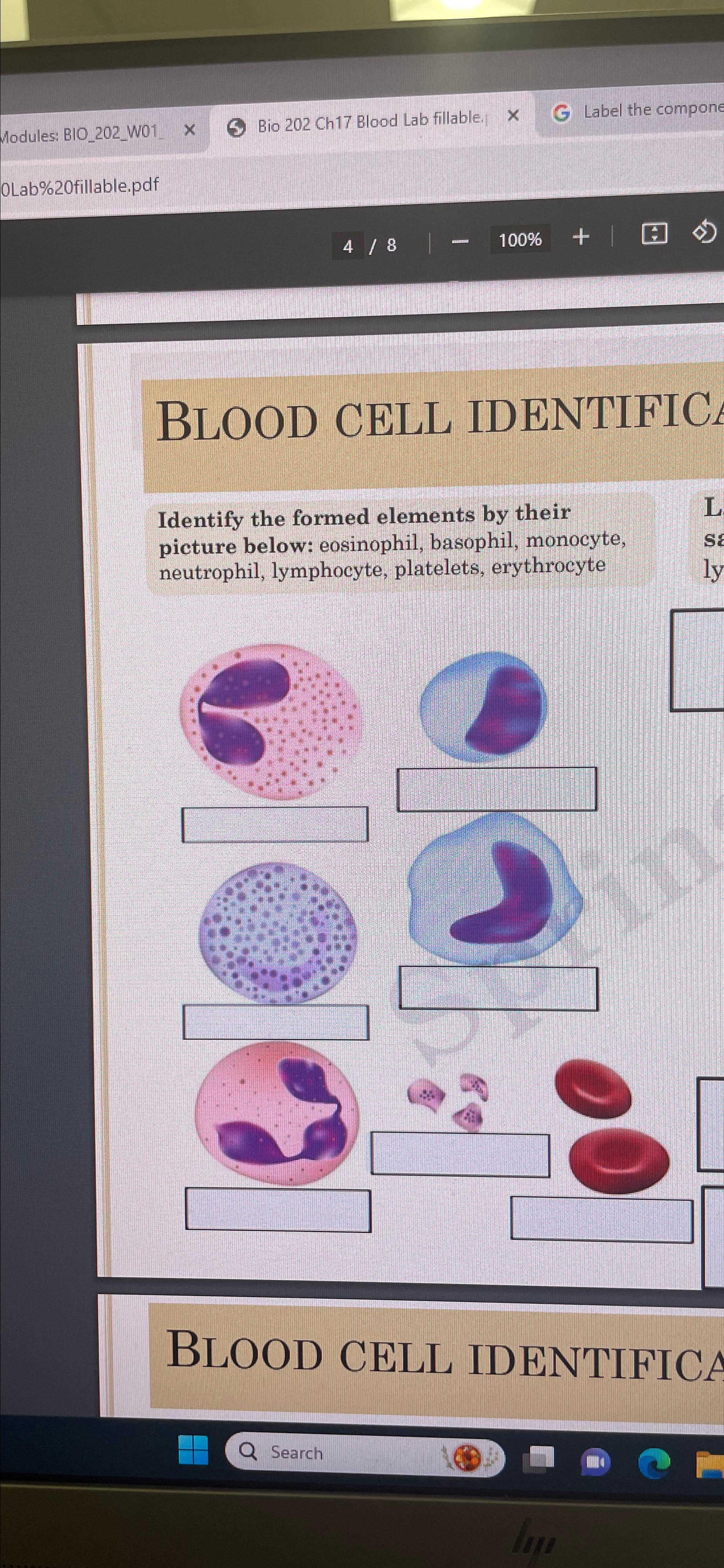 Solved Modules: BIO_202_W01Bio 202 ﻿Ch 17 ﻿Blood Lab | Chegg.com