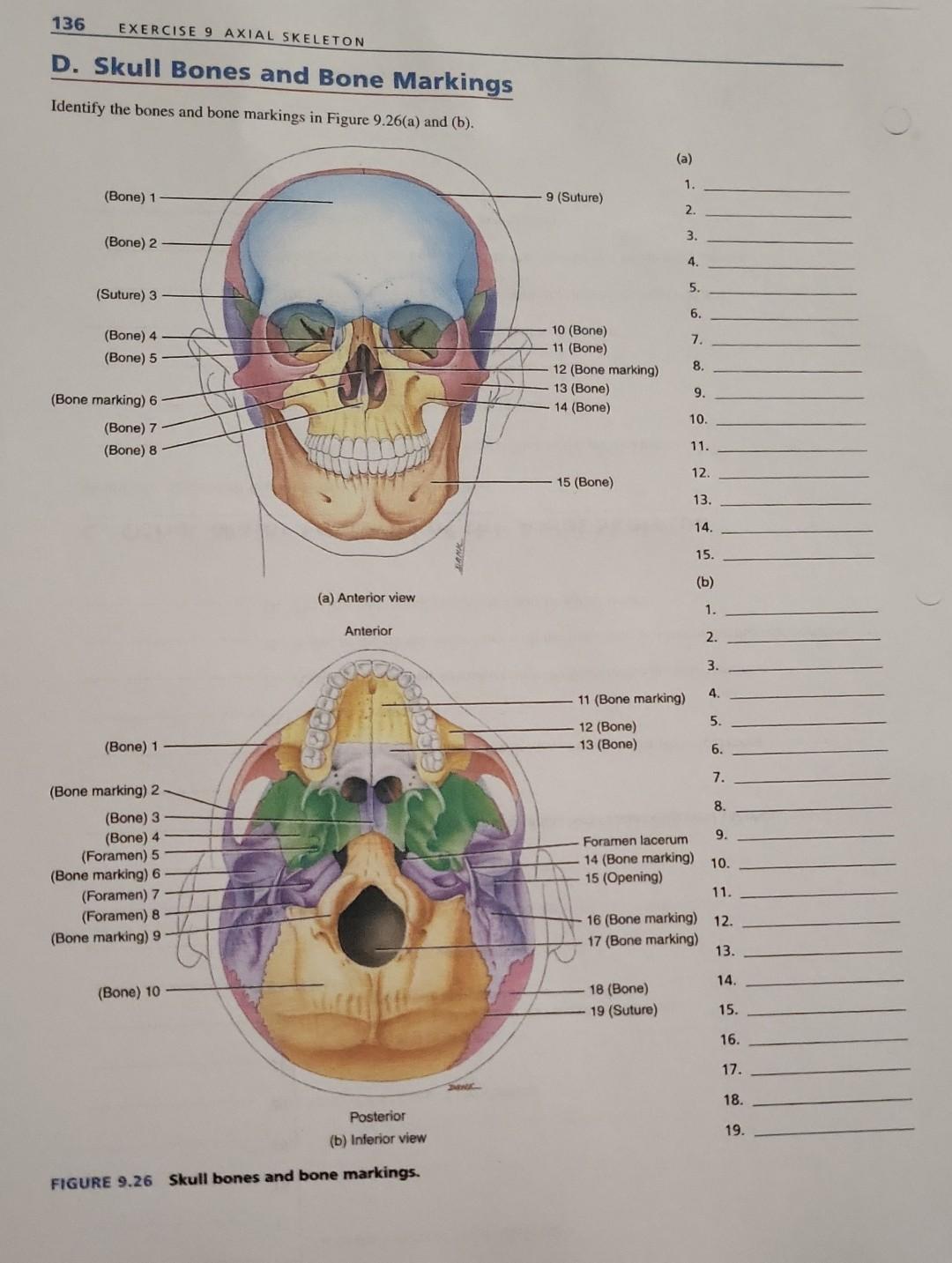 Sinus Bone Marking