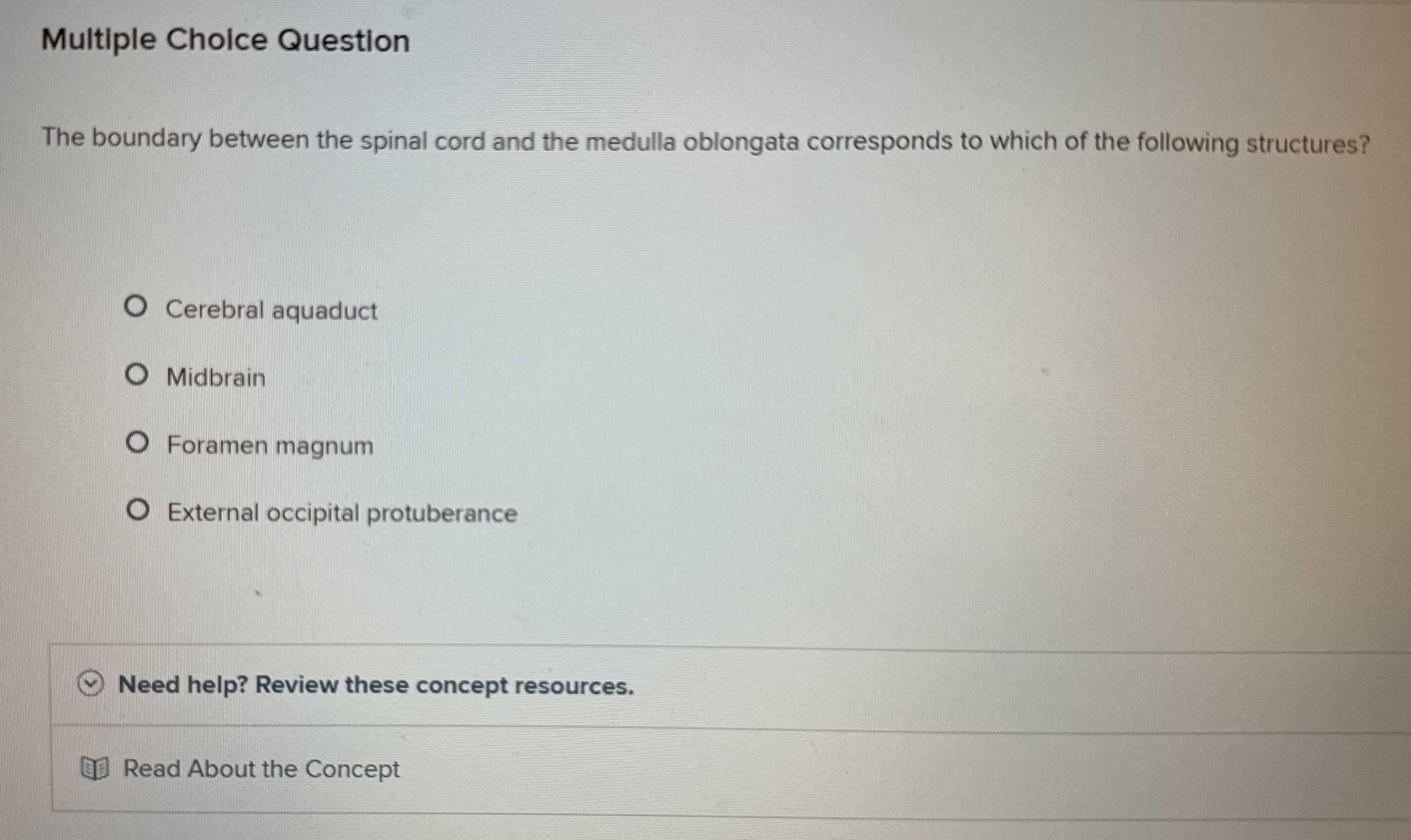 Solved Multiple Choice QuestionThe boundary between the | Chegg.com