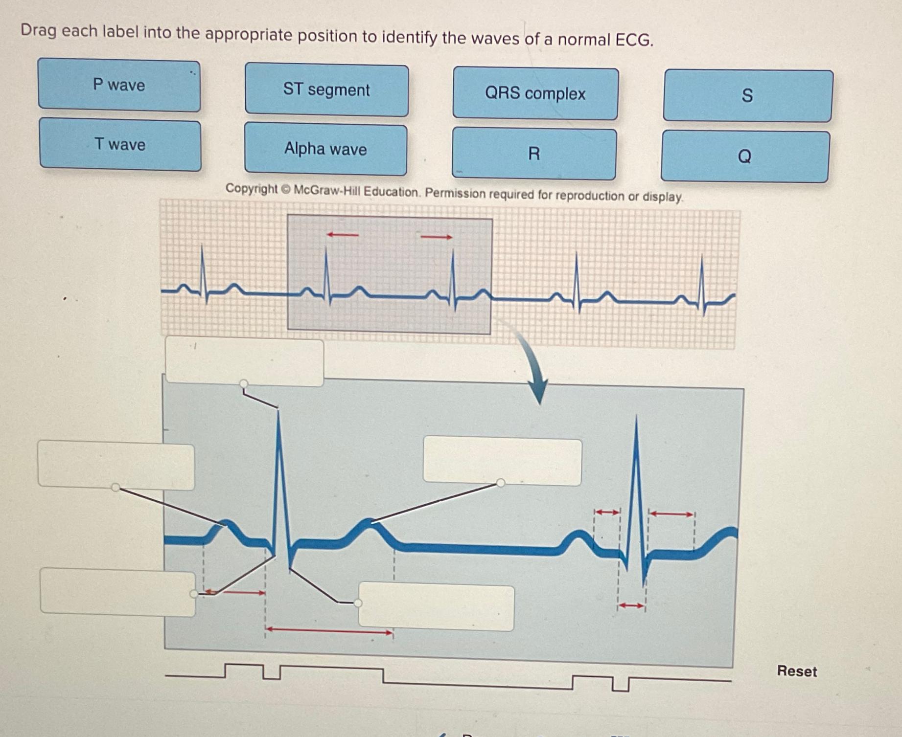 Solved Drag each label into the appropriate position to | Chegg.com