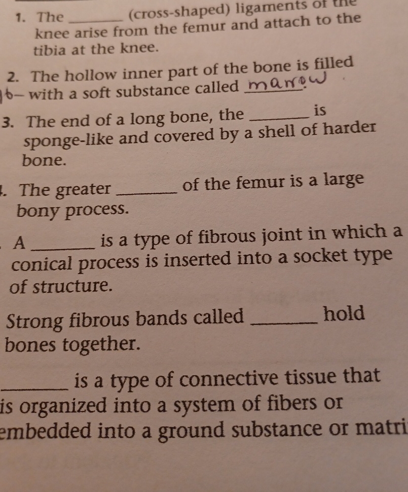 High Quality SOLUTION The q, (cross-shaped) ﻿ligaments of the knee arise | Chegg.com