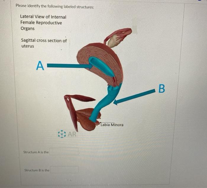 Solved Please identify the following labeled structures: | Chegg.com