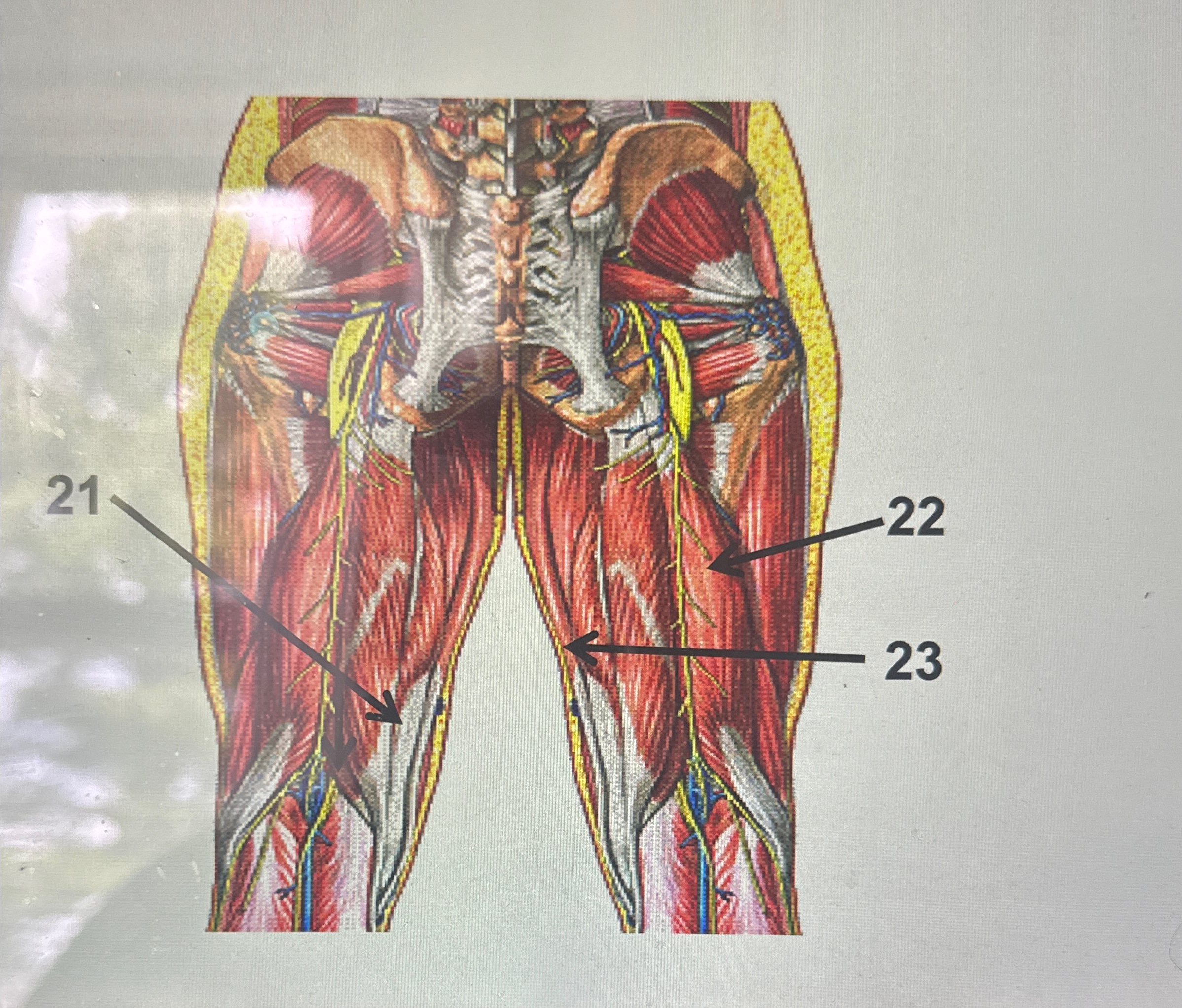 Solved Write down the names of the muscles and their action | Chegg.com