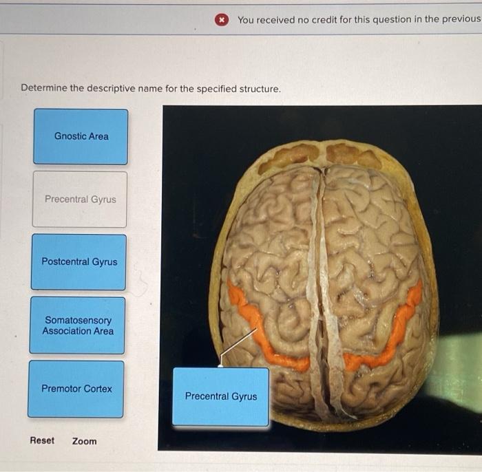 Solved You received no credit for this question in the | Chegg.com