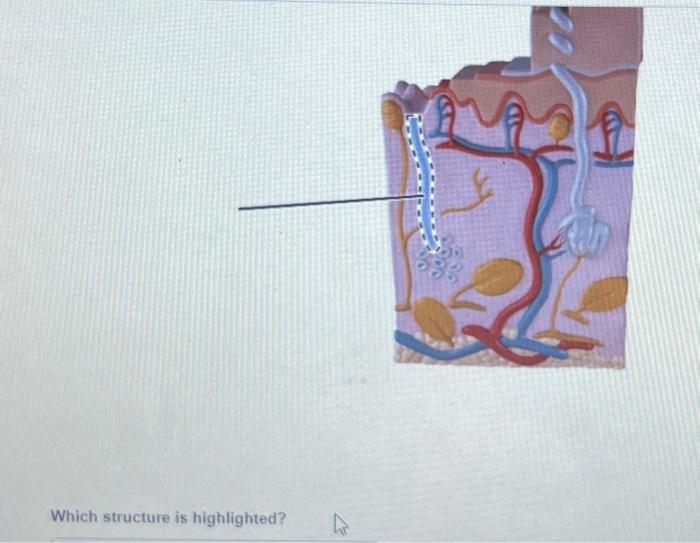 Solved Which structure is highlighted? | Chegg.com