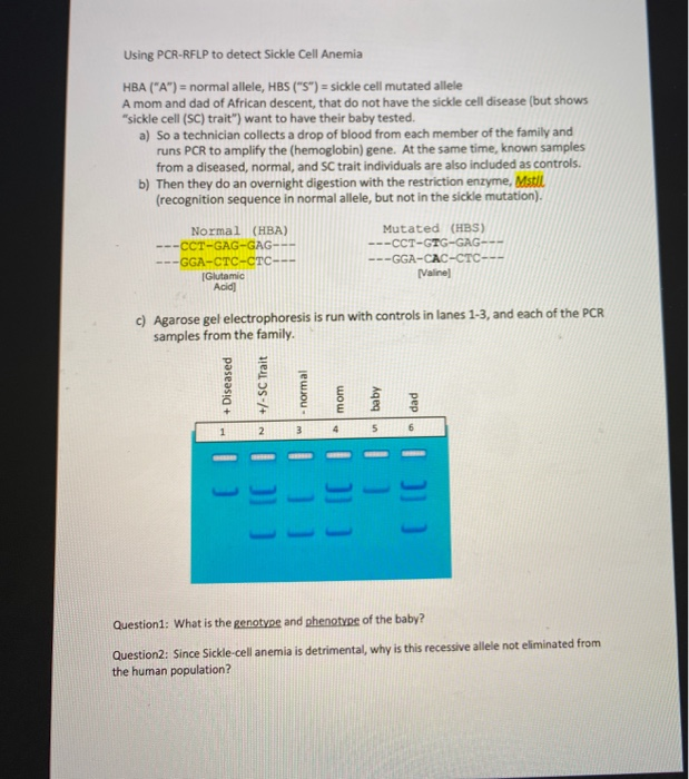 Solved Using PCR-RFLP to detect Sickle Cell Anemia HBA ("A") | Chegg.com