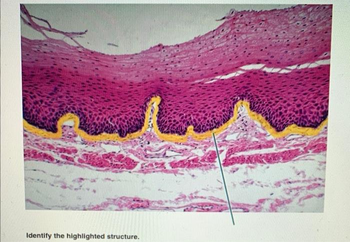 Solved Identify the highlighted structure. | Chegg.com