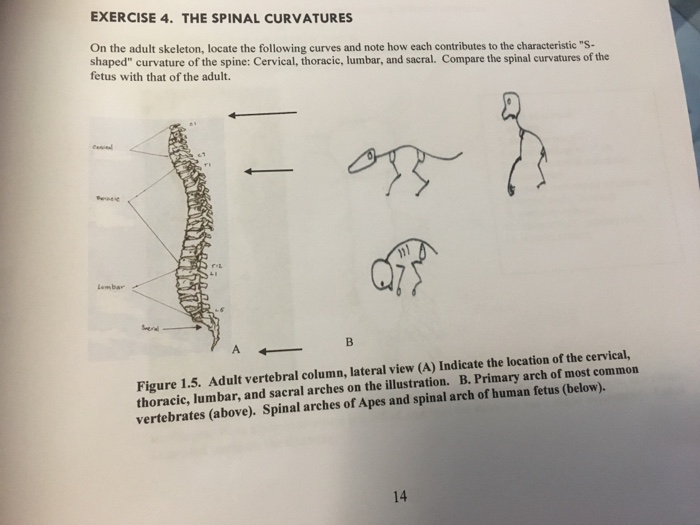 Real Life Hunchback With 100 Degrees Curved Spine Has 100