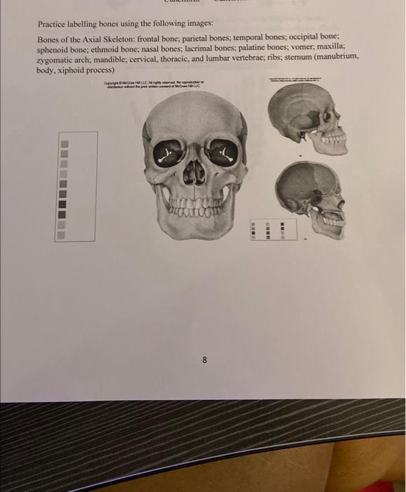 Solved Practice labelling bones using the following images: | Chegg.com