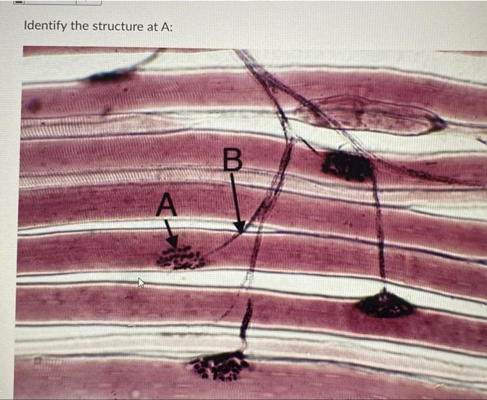 Solved Identify the structure at A: B A O muscle fiber | Chegg.com