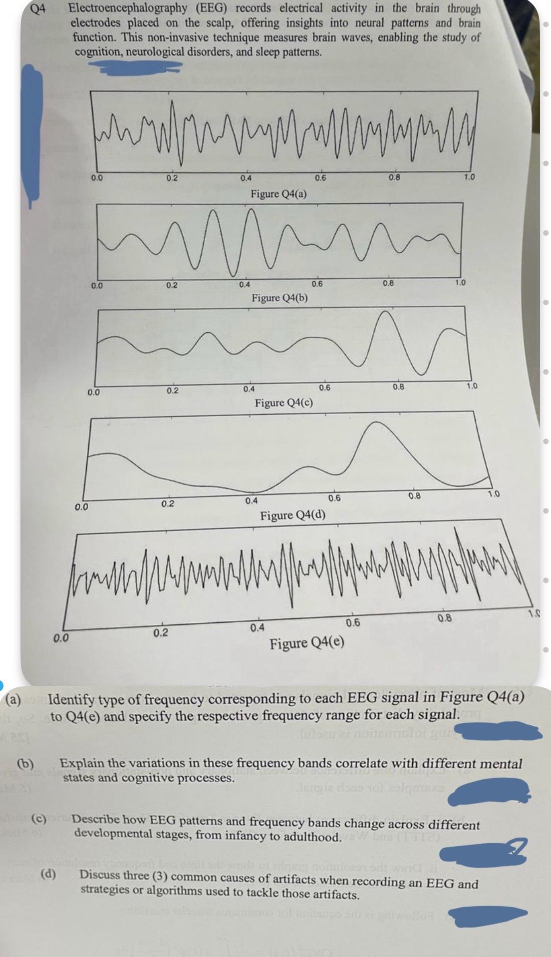 Solved Q4Electroencephalography (EEG) ﻿records electrical | Chegg.com