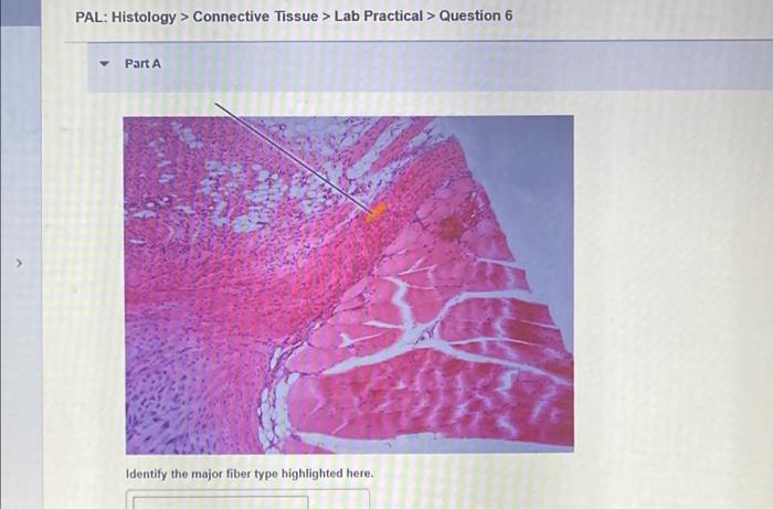 Solved PAL: Histology > Connective Tissue > Lab Practical > | Chegg.com