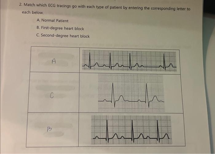 Solved 2. Match which ECG tracings go with each type of | Chegg.com