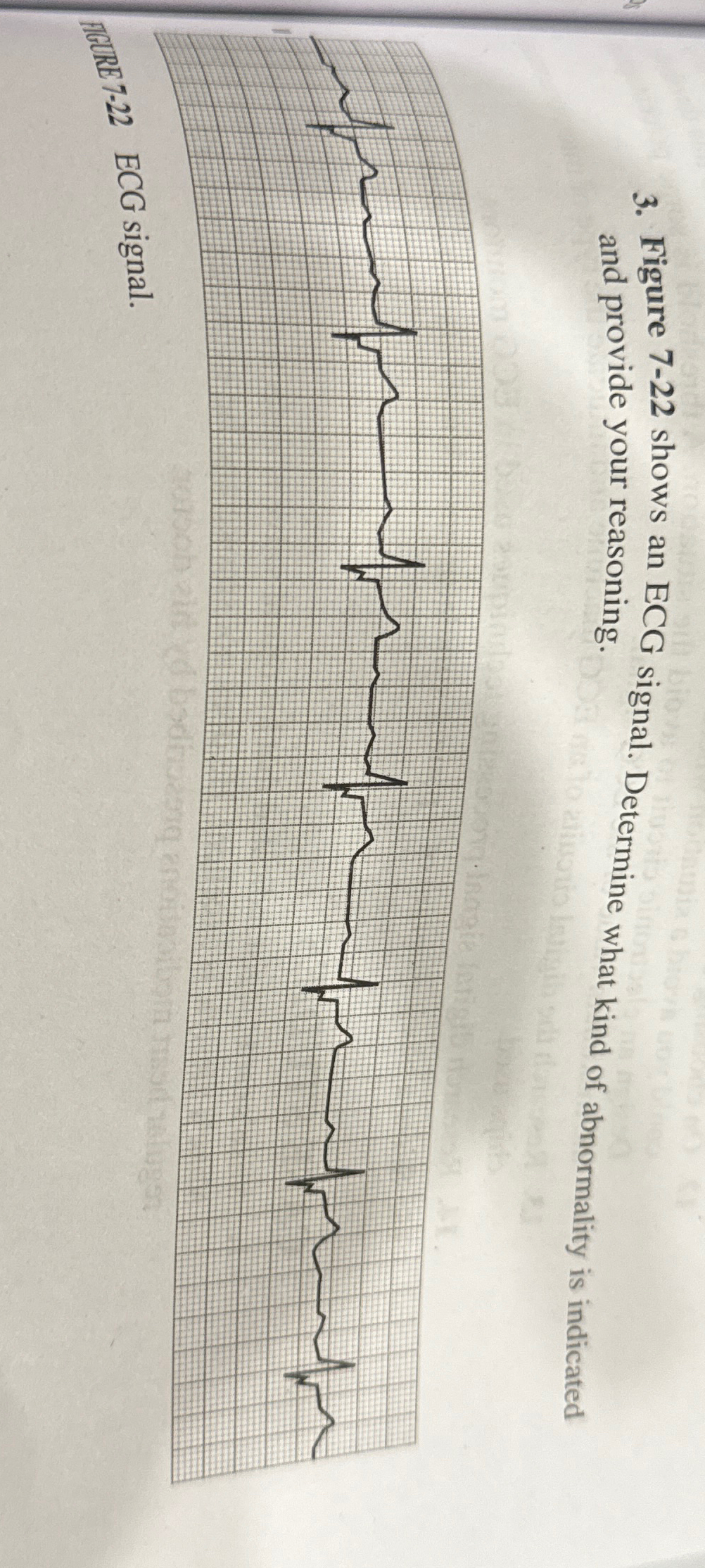 Solved Figure 7-22 ﻿shows an ECG signal. Determine what kind | Chegg.com