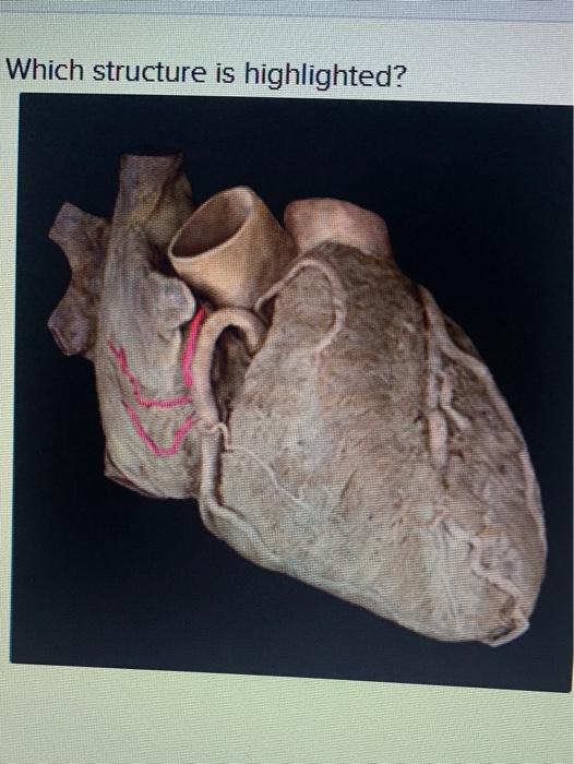 Solved Which structure is highlighted? O left posterior | Chegg.com