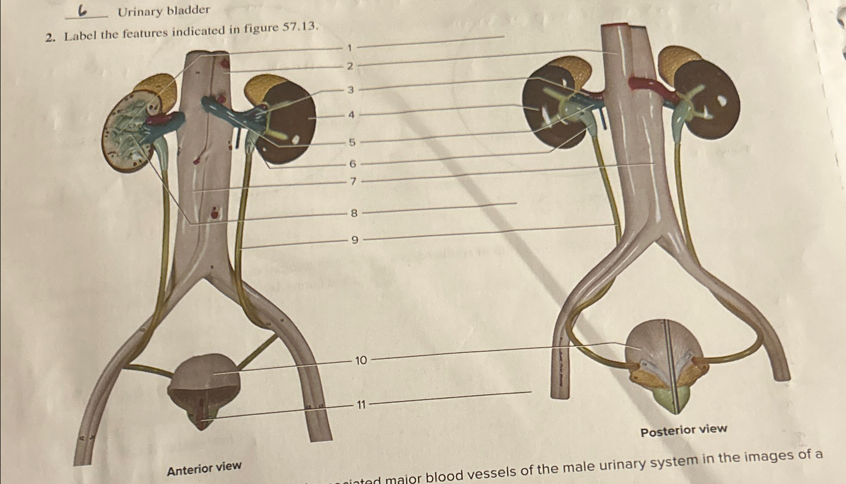 Solved 6Urinary bladder2. ﻿Label the features indicated in | Chegg.com
