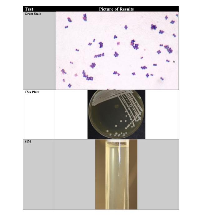 Solved Test Gram Stain Picture of Results TSA Plate be SIM | Chegg.com