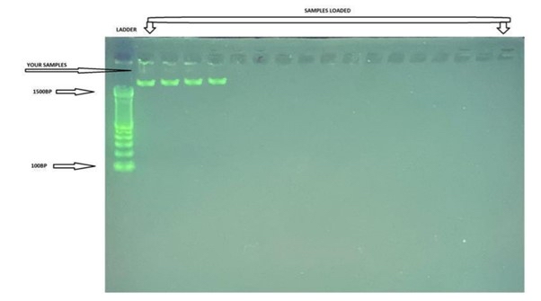 Solved Experiment : DNA extraction & gelelectrophoresis. 1. | Chegg.com