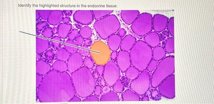 Solved Identify the highlighted structure in the endocrine | Chegg.com