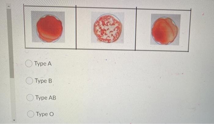 Solved What ABO blood group does this sample belong to? | Chegg.com
