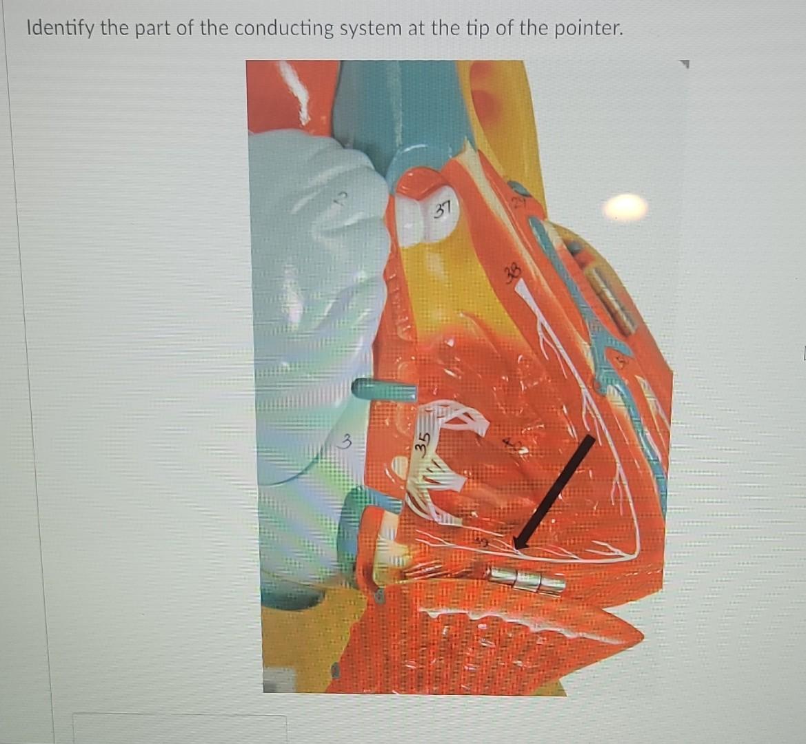 Solved Identify the part of the conducting system at the tip | Chegg.com