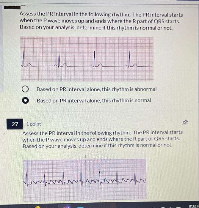 Solved Step 4: Assess the PR interval The normal PR interval | Chegg.com
