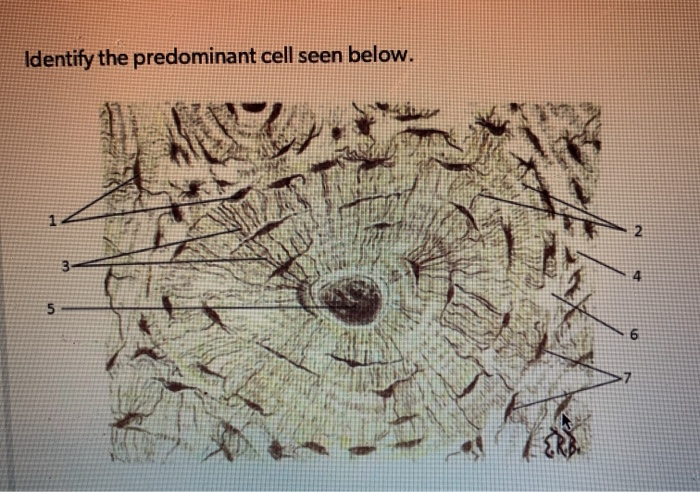 Solved Identify the predominant cell seen below. ity 3 5 | Chegg.com