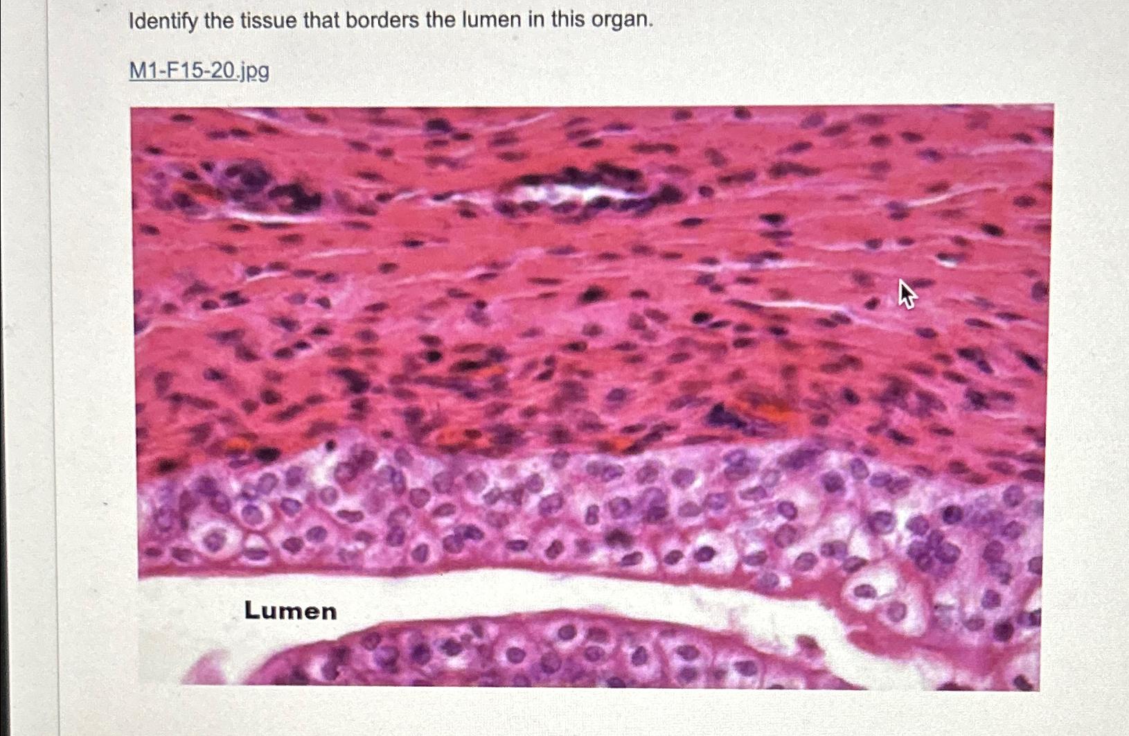 Solved Identify the tissue that borders the lumen in this | Chegg.com