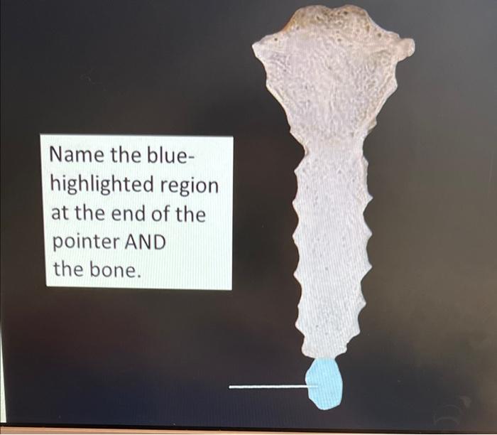 Solved Name the blue-highlighted structure(s) at the end of | Chegg.com