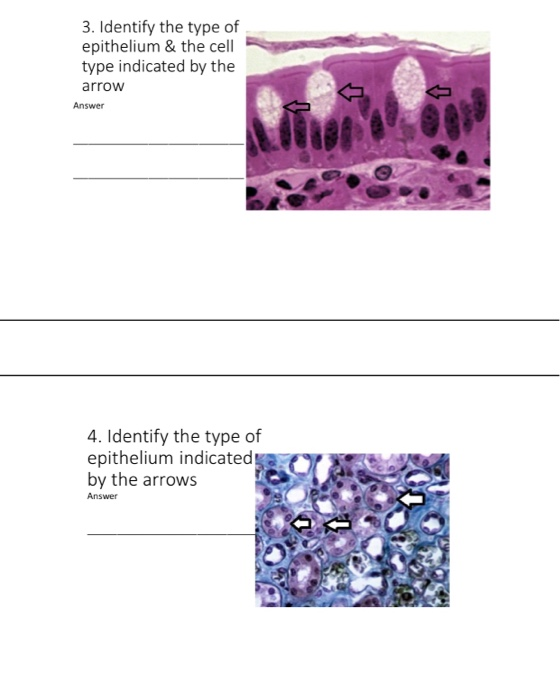 Solved 1. Identify the epithelium type indicated by the | Chegg.com