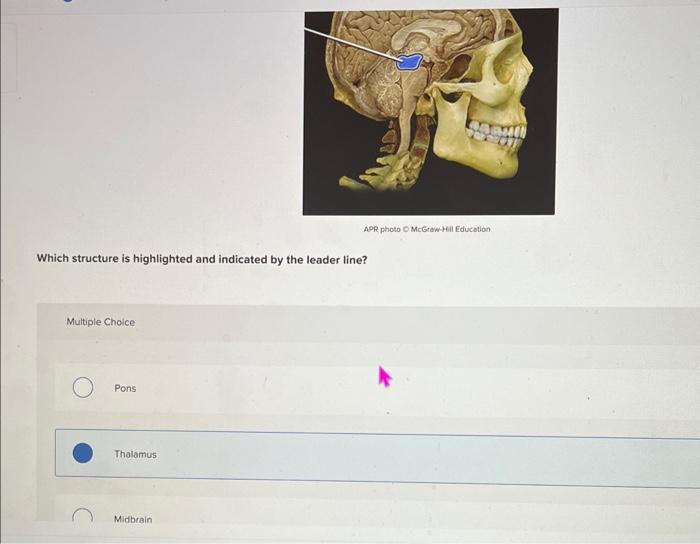 Solved APR photo O McGraw Hill Education Which structure is | Chegg.com