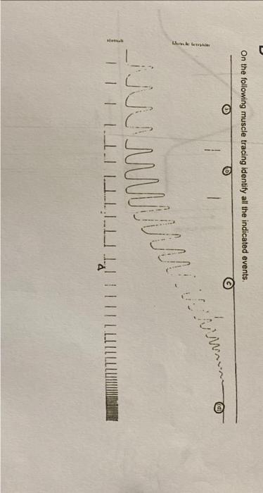 On the followina muscle tracing identifv all the | Chegg.com