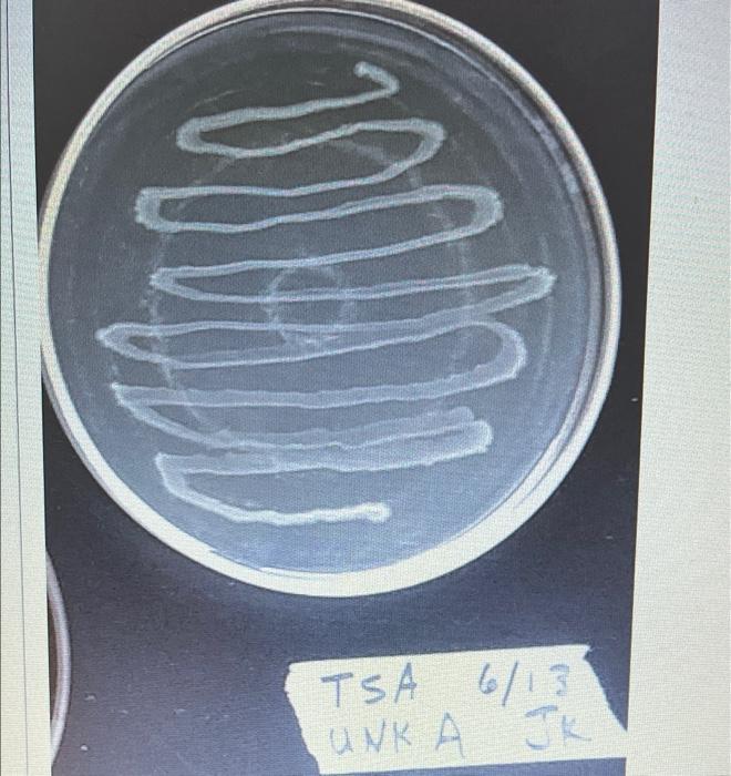Solved PEA 6/13 АК s TSA 6/13 UNK A JK PEA Plate coli | Chegg.com