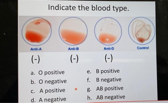 Solved Indicate the blood type. Anti-A Anti-B Anti-D Control | Chegg.com