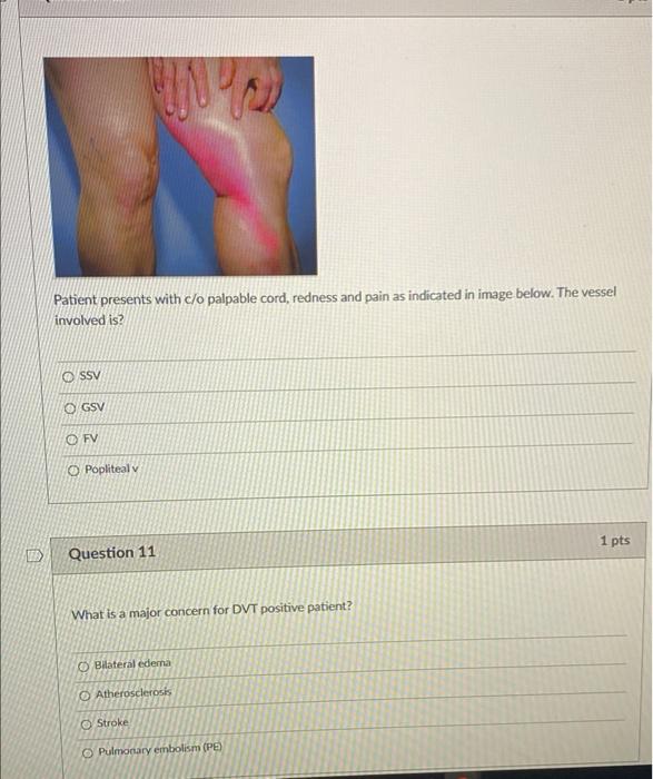 Solved Patient presents with c/o palpable cord, redness and | Chegg.com