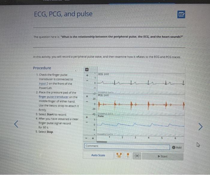 Solved ECG, PCG, and pulse E The question here is: What is | Chegg.com