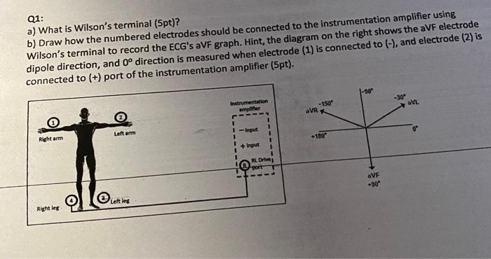 Q1: a) What is Wilson's terminal (5pt)? b) Draw how | Chegg.com