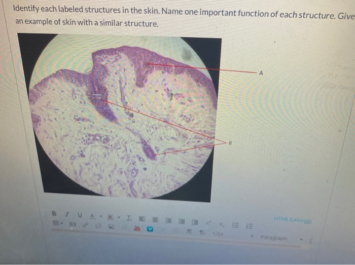 Solved Identify each labeled structures in the skin. Name | Chegg.com