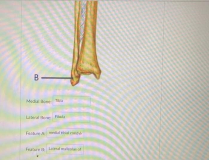 Solved Lateral Bone | Chegg.com