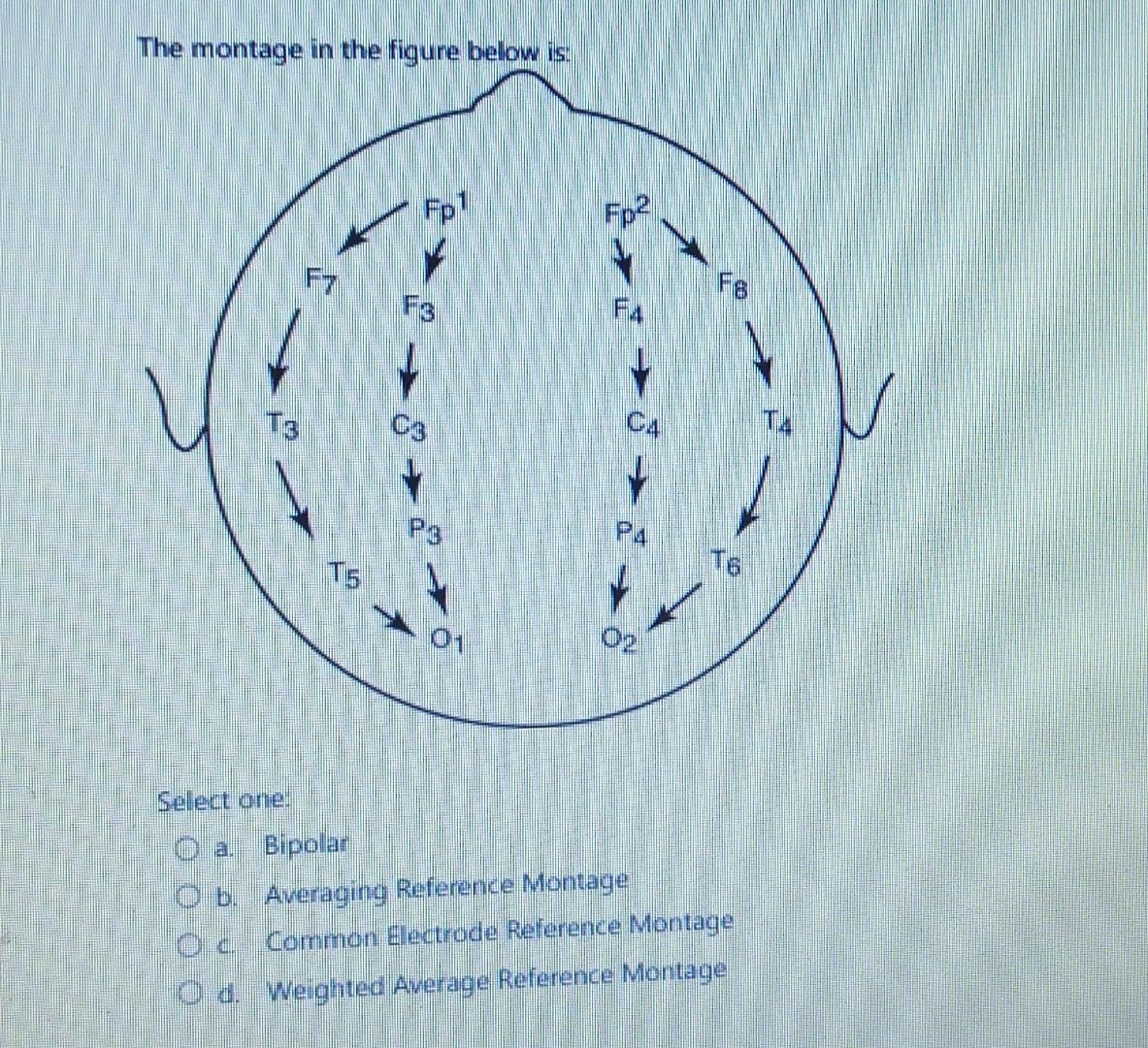 Solved The montage in the figure below is Fp! Fp2 F4 C4 P3 | Chegg.com