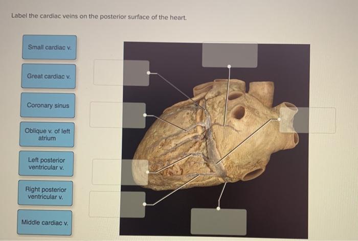 Solved Label the cardiac veins on the posterior surface of | Chegg.com