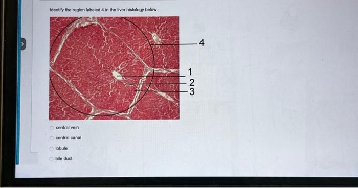 Solved Identify the region labeled 4 in the liver histology | Chegg.com