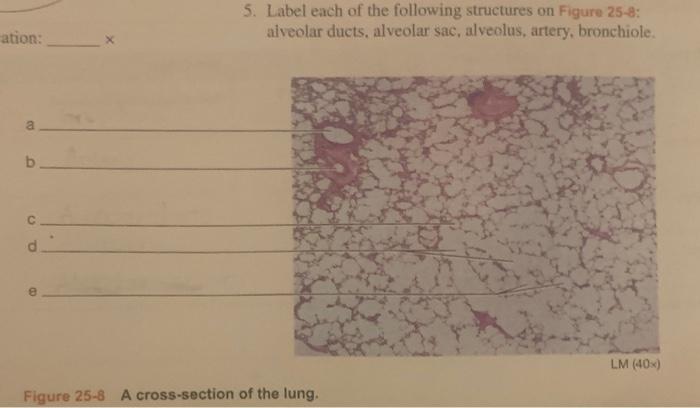 Solved 5. Label each of the following structures on Figure | Chegg.com