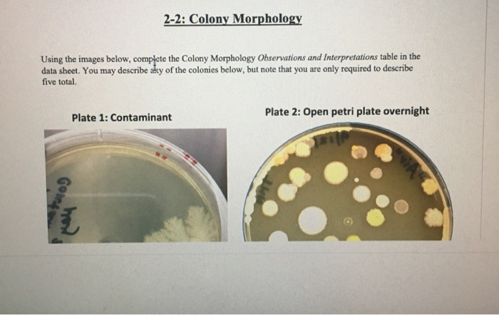 2-2: Colony Morphology Using the images below, | Chegg.com