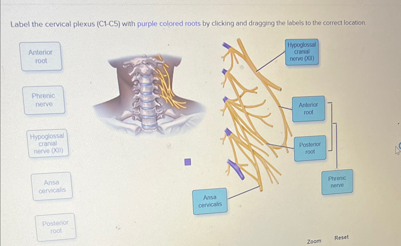 Solved Label the cervical plexus (C1-C5) ﻿with purple | Chegg.com